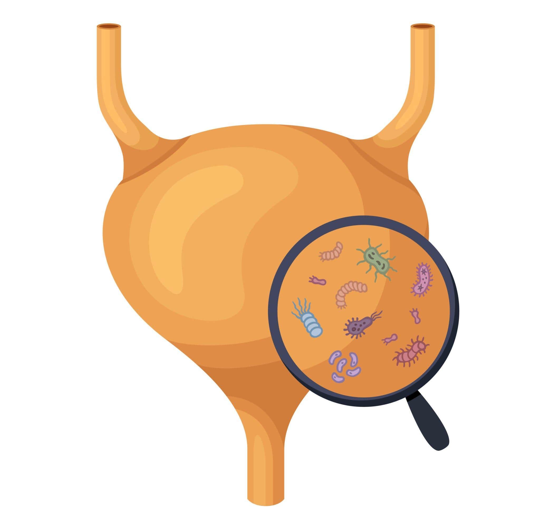 All you need to know about urinary tract infection - 21st Century ...